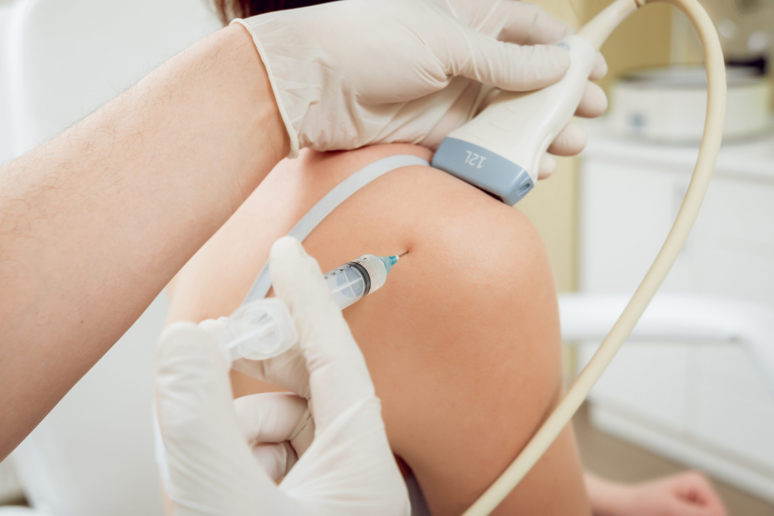 Hydrodilatation for Frozen Shoulder - Invicta Health and Performance ...